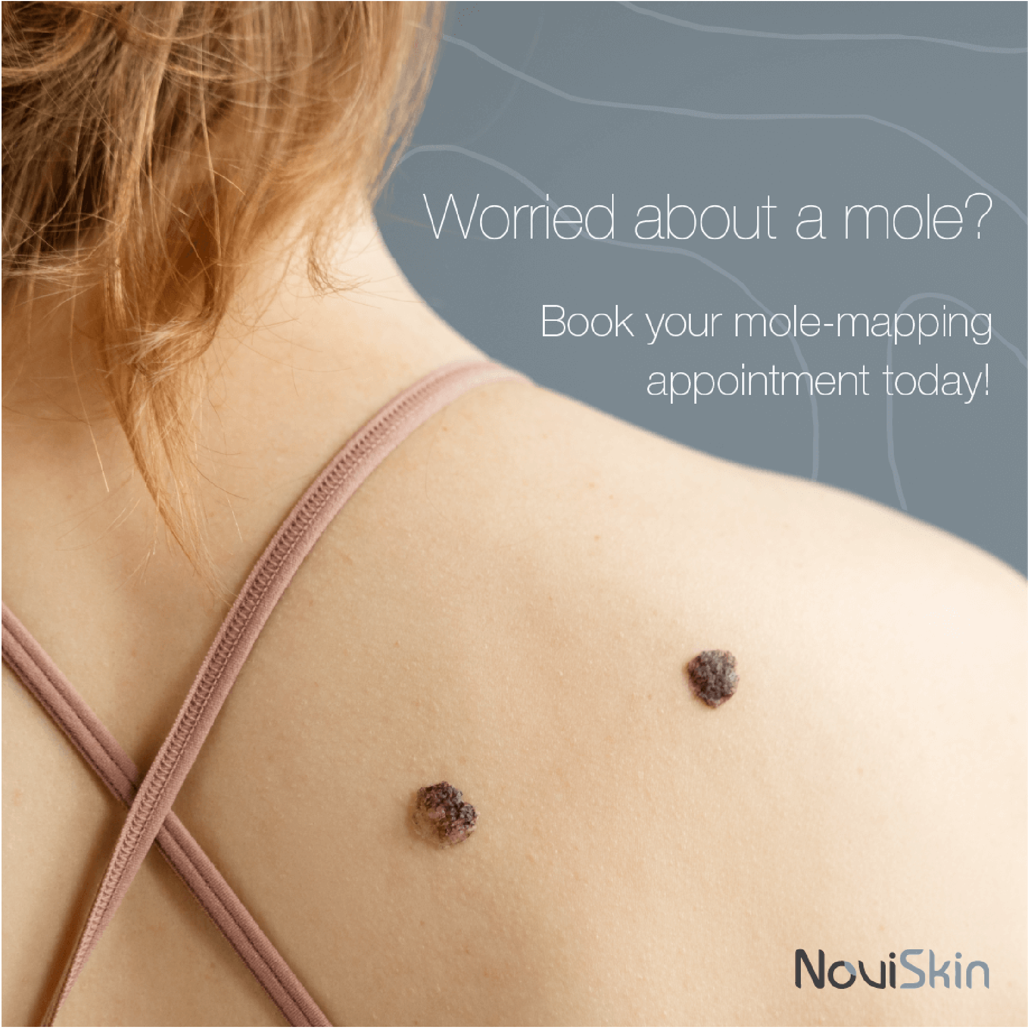 How to detect skin cancer early | Prevention Recommendations
